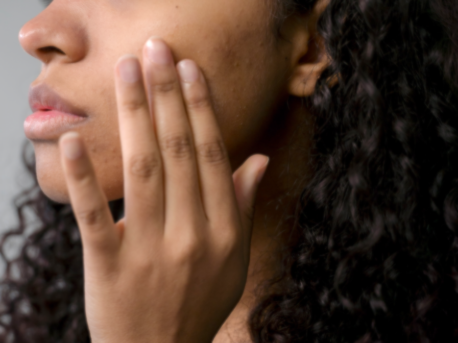 BHAs in a Routine – C&Co.® Handcrafted Skincare